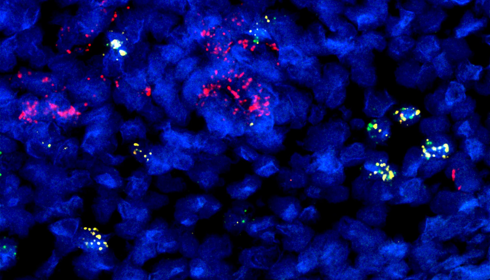 Human Cell Atlas Papers Featured in Nature Collection